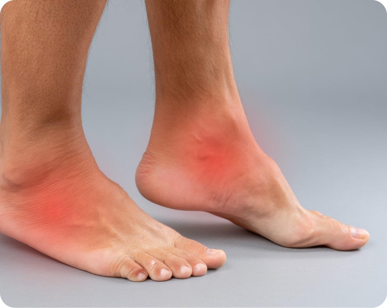 Peripheral Neuropathy | DRJPRiar